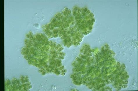 Microcystis Sp