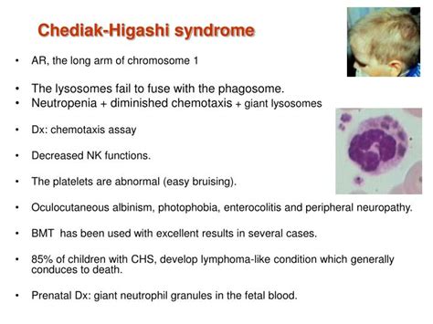 Ppt Primary Immunodeficiencies Powerpoint Presentation Id6656010