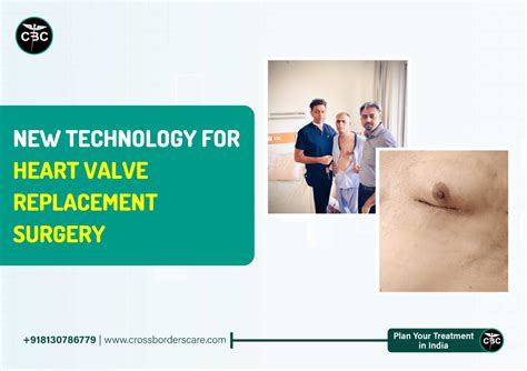 Valve Replacement Surgery And Its Cost