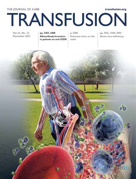 How Do I Implement Pathogen‐reduced Platelets Pham 2021