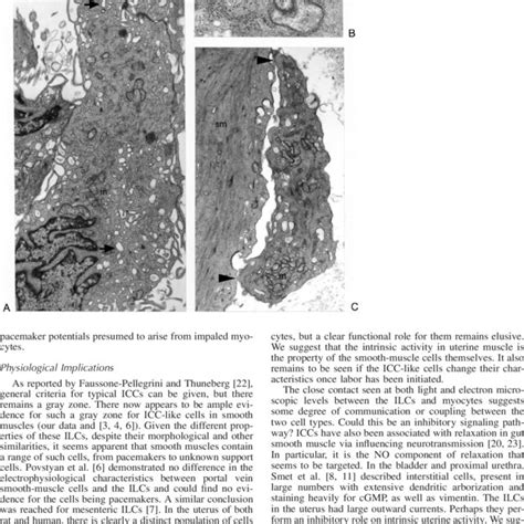 Electronmicrographs Of Ilcs In Dispersed Cell Preparations From Human Download Scientific