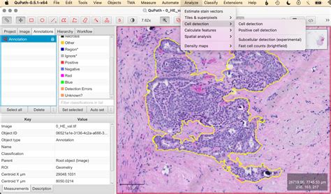 Qupath Cell Counting Cancer Informatics
