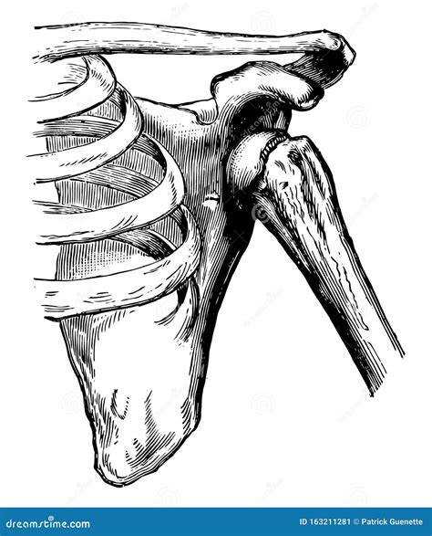 Dislocation Of The Humerus Vintage Illustration Stock Vector