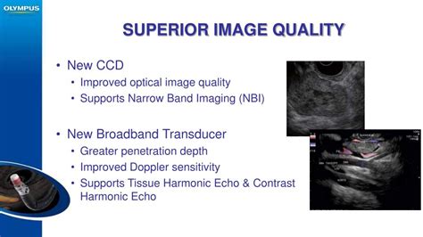 Ppt Olympus Eus Powerpoint Presentation Free Download Id3201218