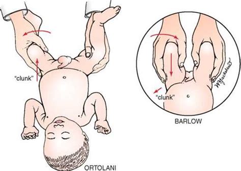 The Pediatric Patient Textbook Of Physical Diagnosis History And
