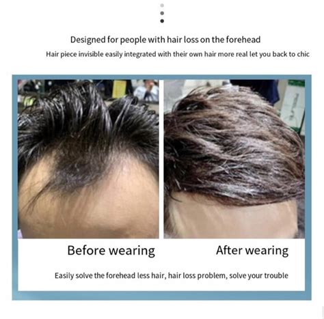 Wig Mens And Womens Hairline Fake Hair Patch Forehead Mens And Women