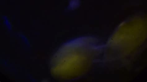 Plankton Considering The Microscope 13432317 Stock Video At Vecteezy