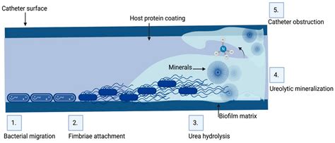 Biofilms On Medical Devices Encyclopedia Mdpi