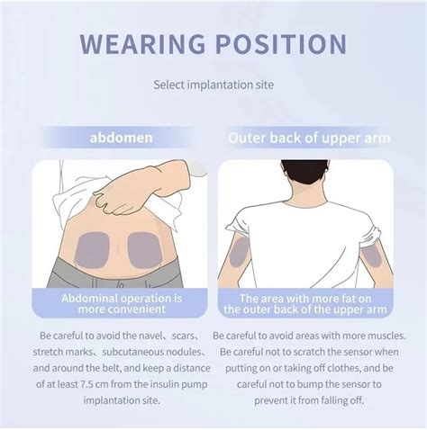 Aidex Ⅱ Dynamic Blood Glucometer Cgm Sensor Wearable Continuous Blood