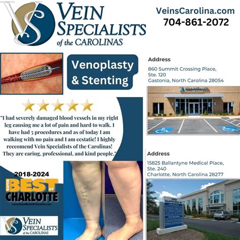 Venoplasty And Stenting Groundbreaking Procedure For Vein Conditions