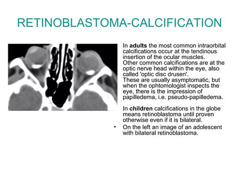 Orbital Ct And Mr Ppt