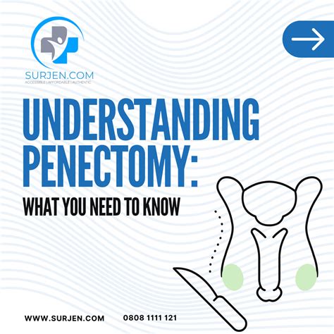 How Carotid Artery Surgery Can Prevent Stroke By Surjen Healthcare