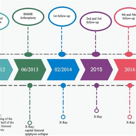 Total Hip Replacement Intraoperative Image Short Modular Femoral Stem
