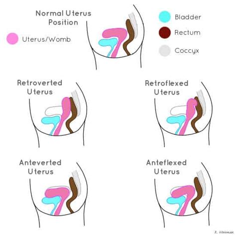 Uterus Positions Fertility And Your Periods Period Whisperer