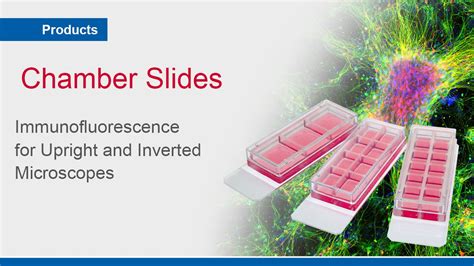 Cells Immunofluorescence Cellbiology Ibidi Gmbh