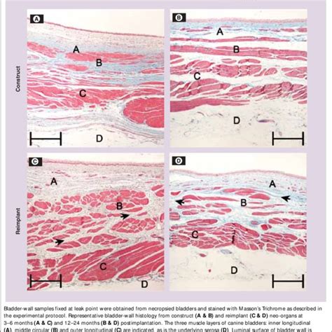 Bladder Wall Histology Download Scientific Diagram