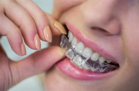 How To Care For Your Invisalign Aligners Tips And Advice