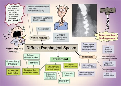 Nutcracker Esophageal Spasm Symptoms At Lola Logan Blog
