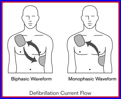 Electronic Equipment Repair Centre Monophasic And Biphasic Defibrillation