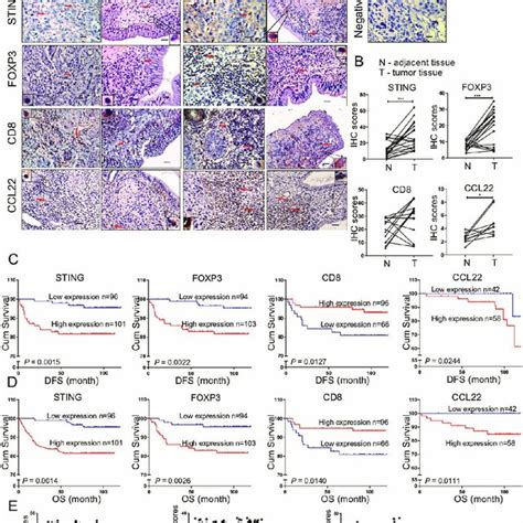 Intratumor Sting Expression Fooxp3 Cells And Cd8 Cells Were