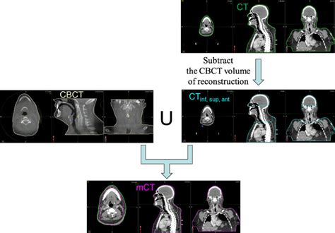 Process Flow To Generate The Modified Ct Body Structure Bodymct By
