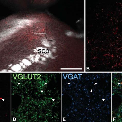Vglut2 Expression By Anterogradely Labelled Spinoparabrachial Axon