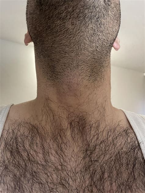 M26 Not Sure What To Do With Chest Hair Rmalegrooming