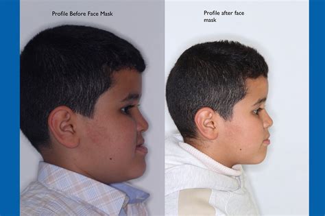 Dental Health Clinic Orthodontics Gallery