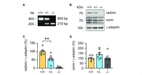 Monoallelic Loss Of Rdx Reduces Radixin Protein Expression In The