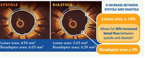 Bioadaptive Bioadaptors Metalfreepci