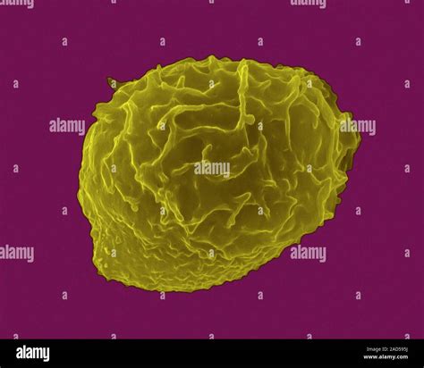 General Diagnostics Immature Granulocytes Absolute