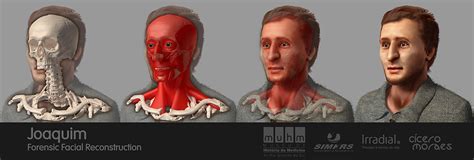 Ator A Skeleton Of Medicines History Museum Have His Face Revealed