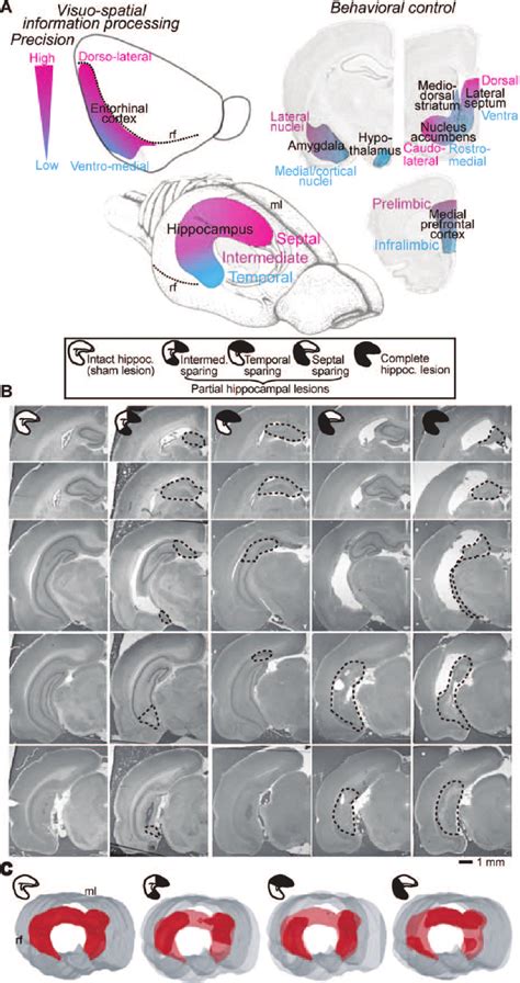 Functional Connectivity Of The Hippocampus Along The Septotemporal Axis