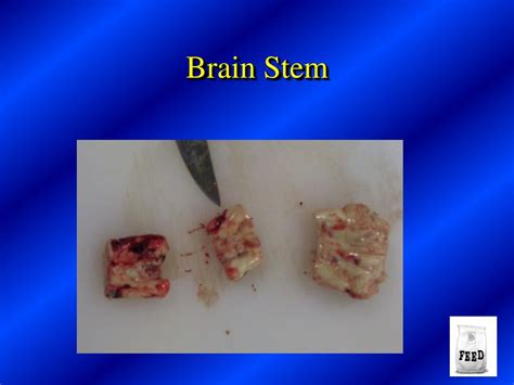 Ppt Transmissible Sponorm Encephalopathies Tses Powerpoint Presentation Id13683