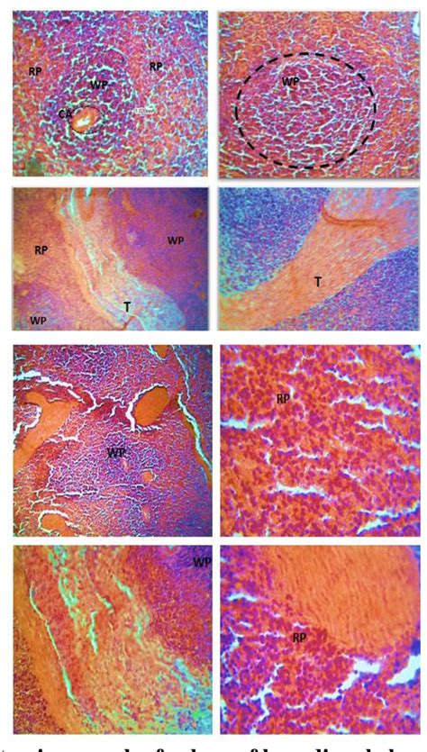 Photograph Of Spleen Of Karadi Male Lamb Showing Parietal Surface And Download Scientific