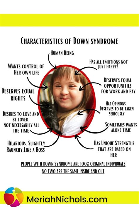 Down Syndrome Artofit