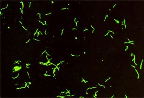 Microbiology 27 Spirochetes Flashcards Quizlet