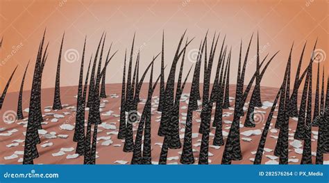 Hair Follicles And Dandruff Under Microscope Stock Illustration Illustration Of Diagnostics