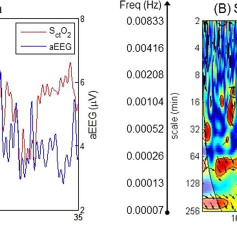 wavelet based s ct o 2 aeeg coherence showing intact neurovascular