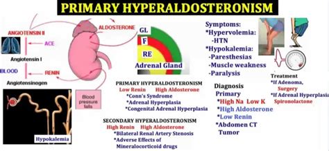 Cushing Syndrome Vs Hyperaldosteronism At Lori Chambers Blog