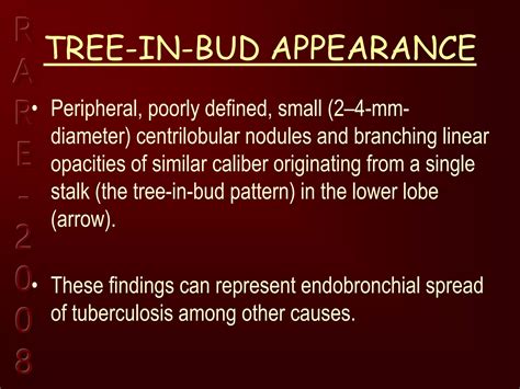Respiratory System Signs Finalppt Radiology Ppt