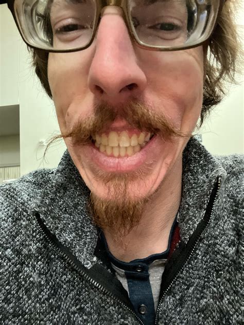 Got My Braces Off Tuesday After 2 1 2 Years R Braces