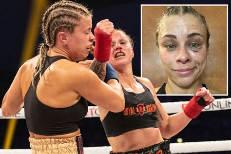 Paige Vanzant Suffers Shock Loss On Bare Knuckle Boxing Debut As