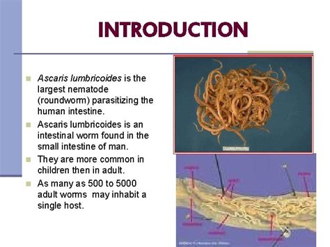 Ascariasis A Common Round Worm Disease By Dr