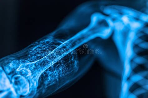 Bone Mri X Ray In Hospital Diagnostics And Medicine And Health Care