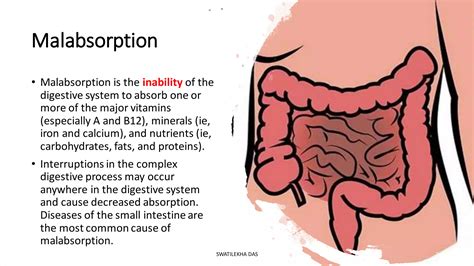 Malabsorption Syndrome Pdf