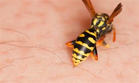 Are Wasp Stings Dangerous Our Warning Pests Banned