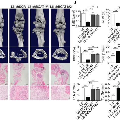 High Expression Of Bcat1 Promotes Cancer Cell Migration And Metastasis