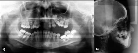 Radiography Of Skull And Jaws Download Scientific Diagram