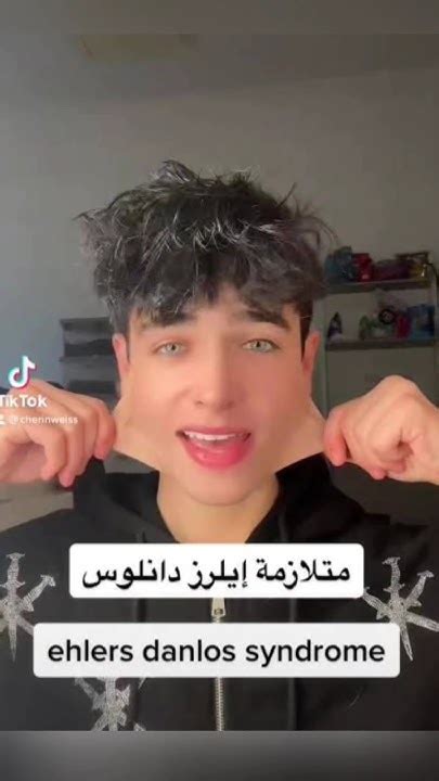 لن تصدق هذا الشخص جلده مطاطي بالكامل 😯 Shorts Youtube